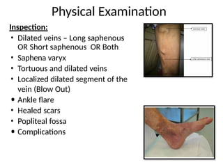 Examination Of Varicose Veins and DVT.pptx