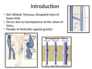 Examination Of Varicose Veins and DVT.pptx