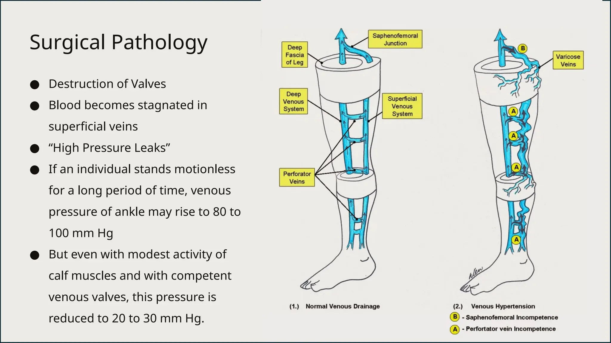 Examination of Varicose Veins & its Radiological Findings | PPTX