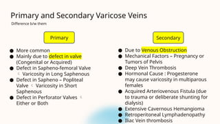 Examination of Varicose Veins & its Radiological Findings | PPTX