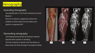 Examination of Varicose Veins & its Radiological Findings | PPTX