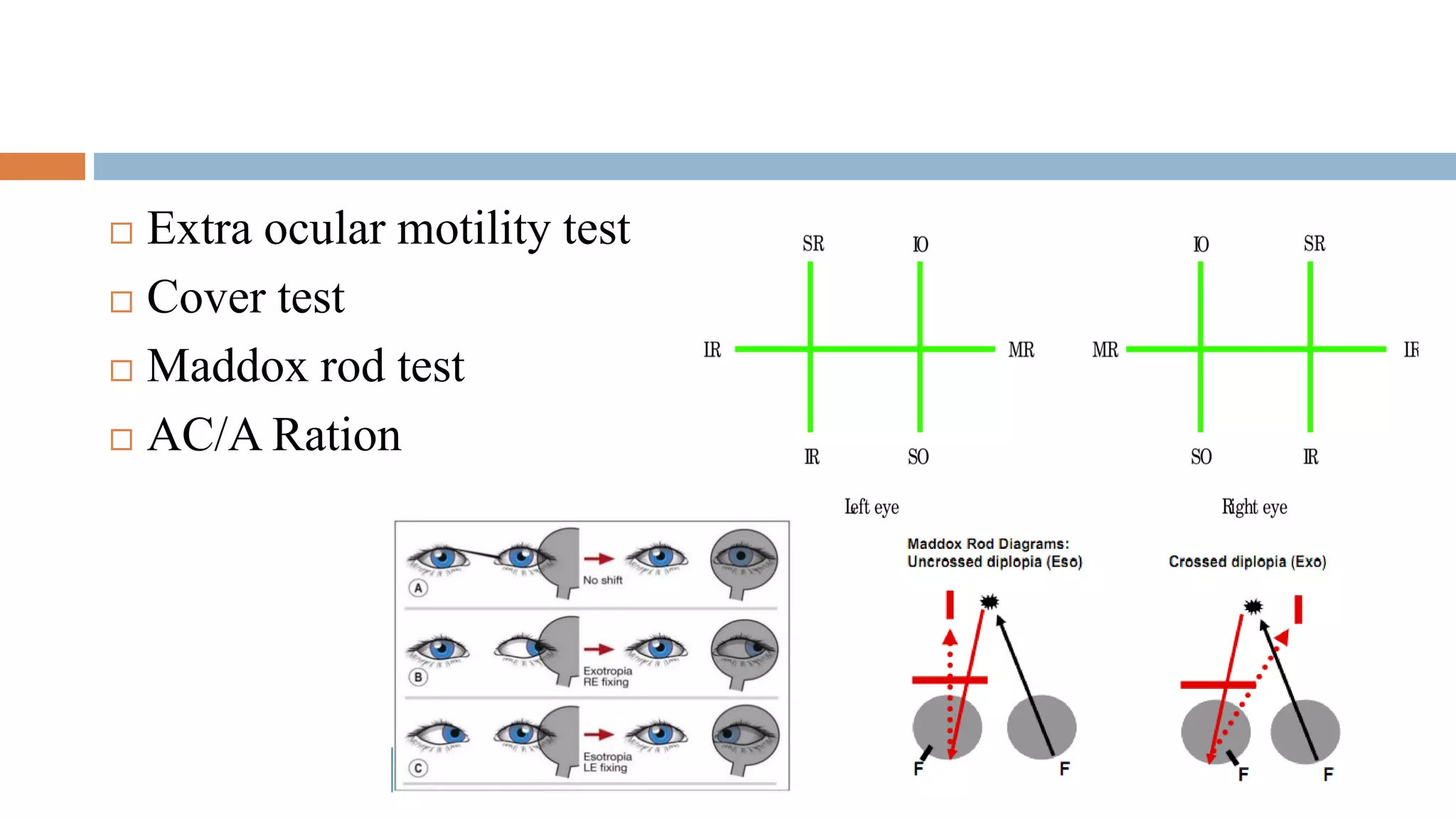 Examination protocol for binocular vision | PDF