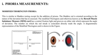 Examination protocol for binocular vision | PDF