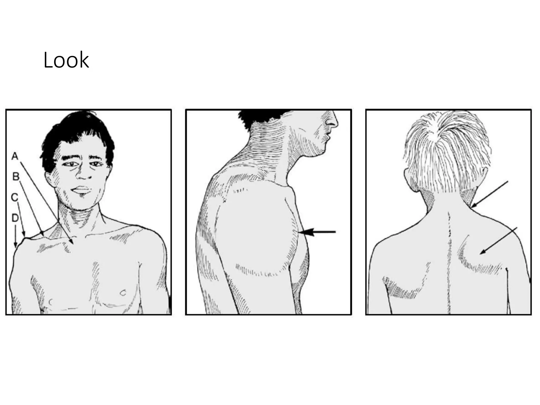 Examination Shoulder (1).pptx
