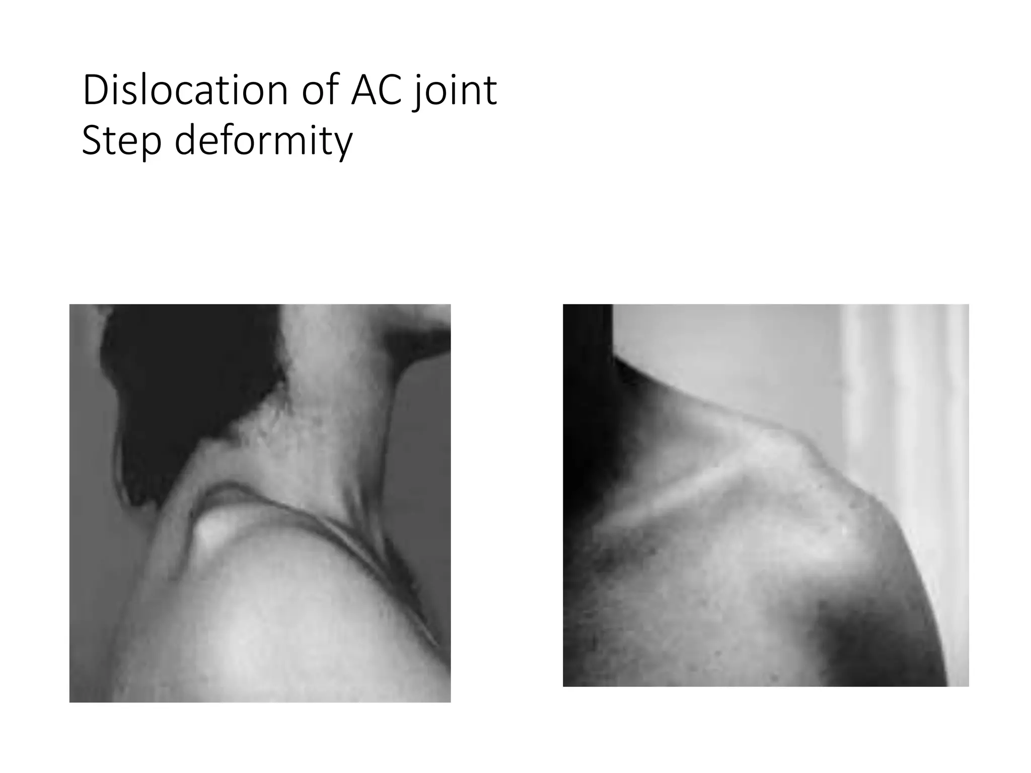 Examination Shoulder (1).pptx