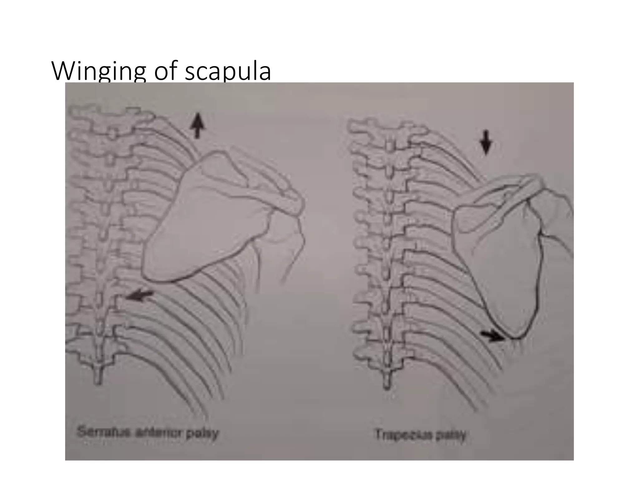 Examination Shoulder (1).pptx