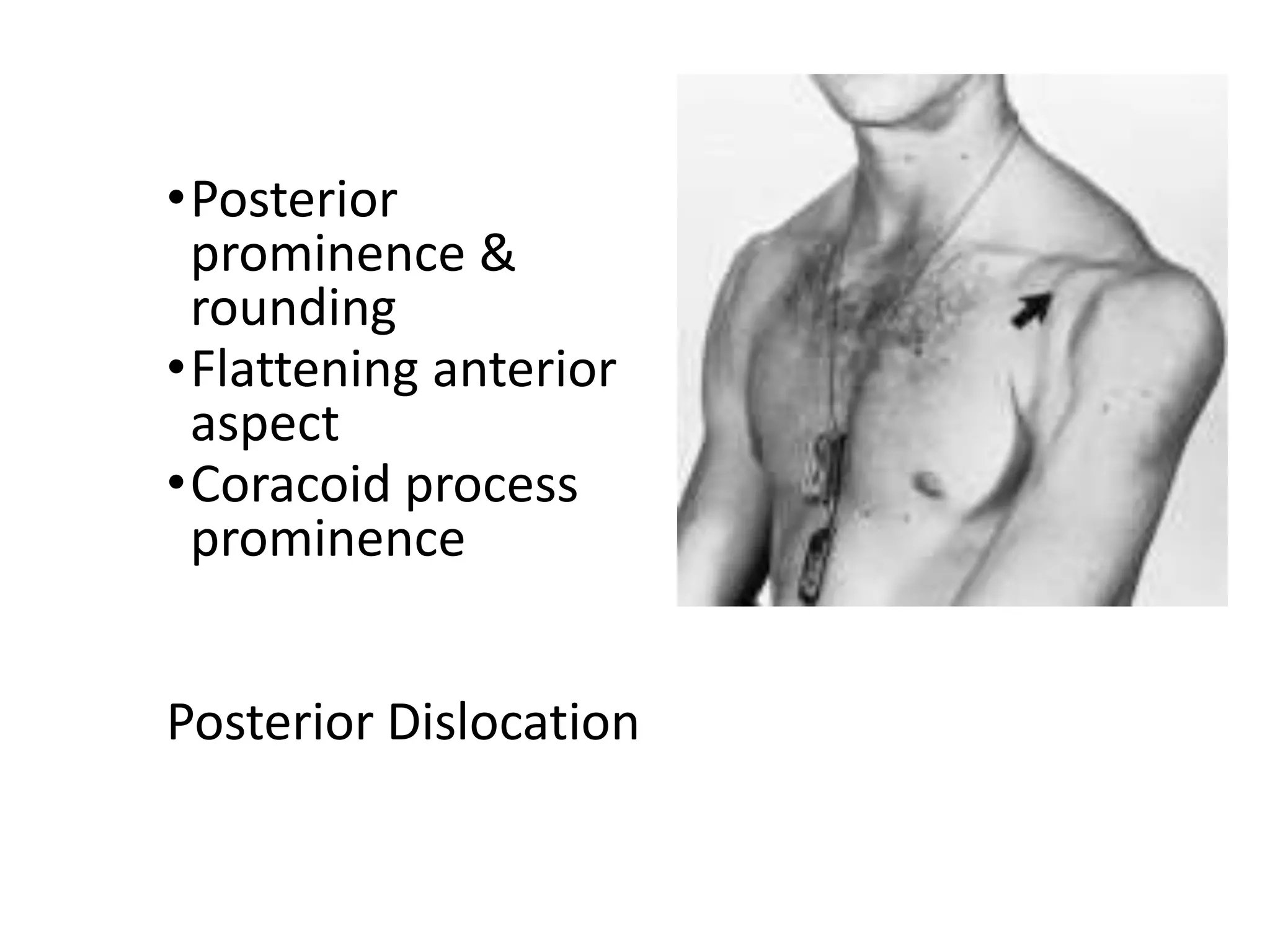 Examination Shoulder (1).pptx