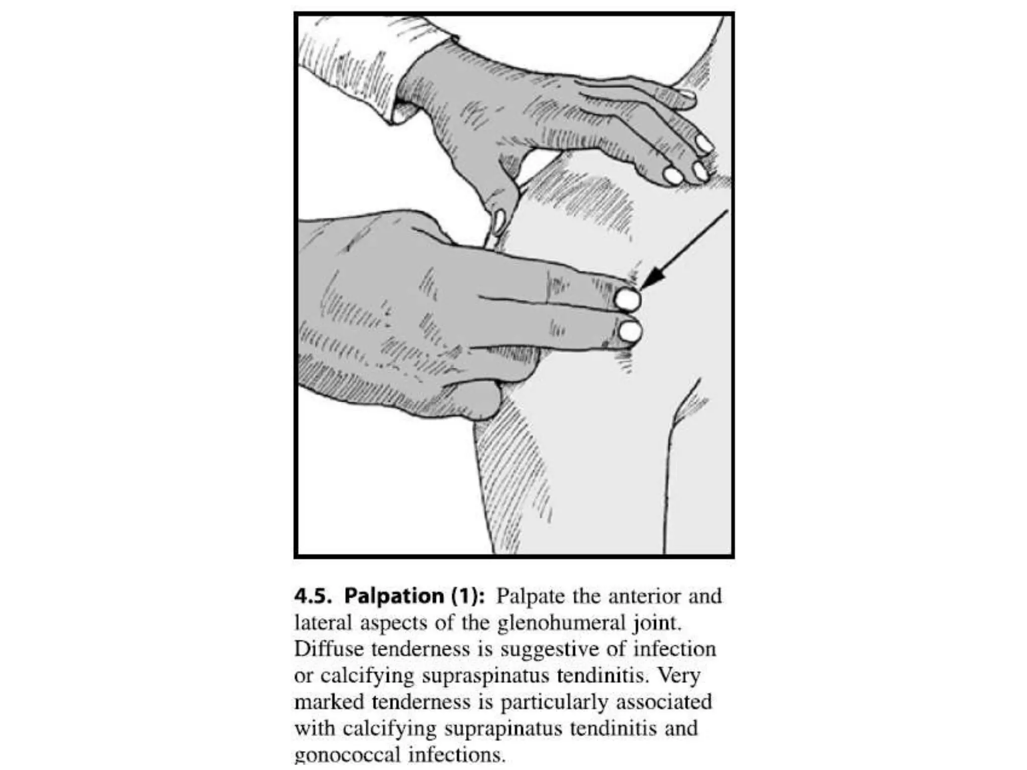 Examination Shoulder (1).pptx