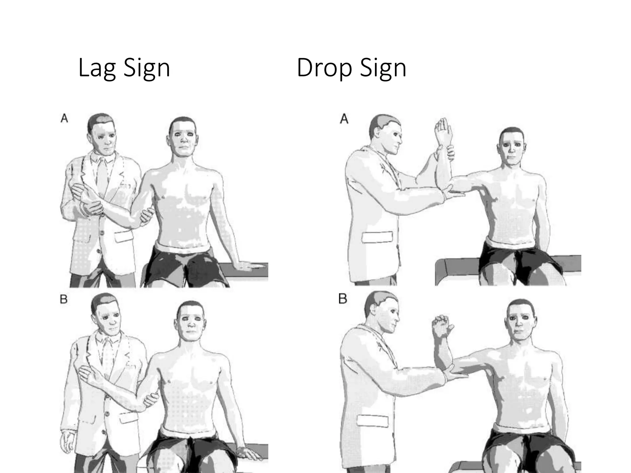 Examination Shoulder (1).pptx
