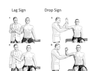 Examination Shoulder (1).pptx