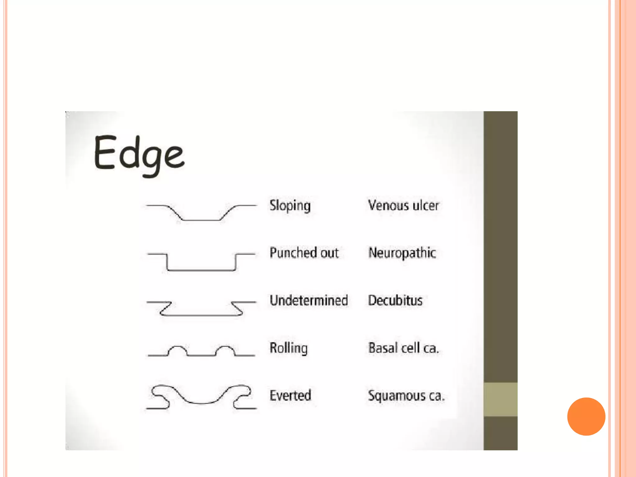 Examinatyion of ulcer | PPTX