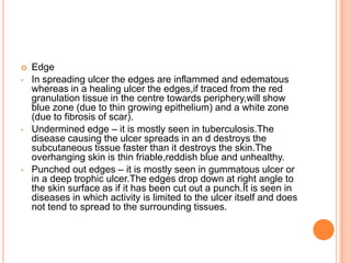 Examinatyion of ulcer | PPTX