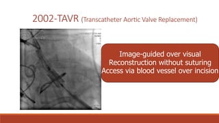 The U.S. News Rankings: Examining Minimally Invasive Surgery (Michael ...