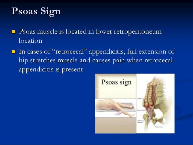 Examining the Acute Abdomen