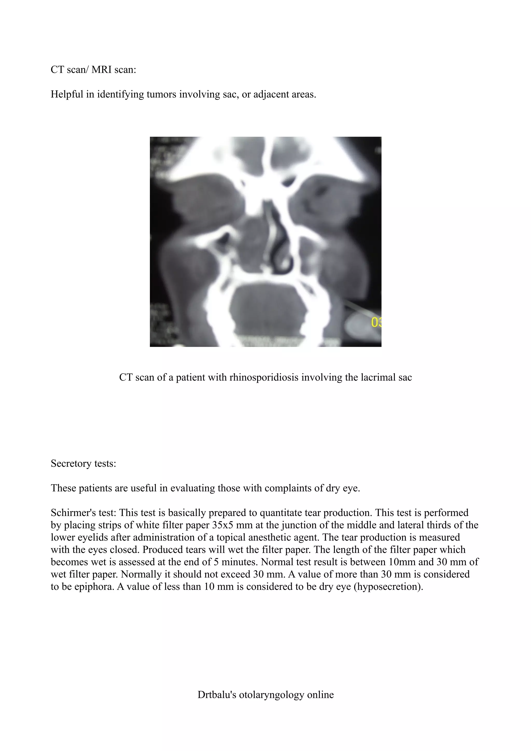 Examination of lacrimal system | PDF