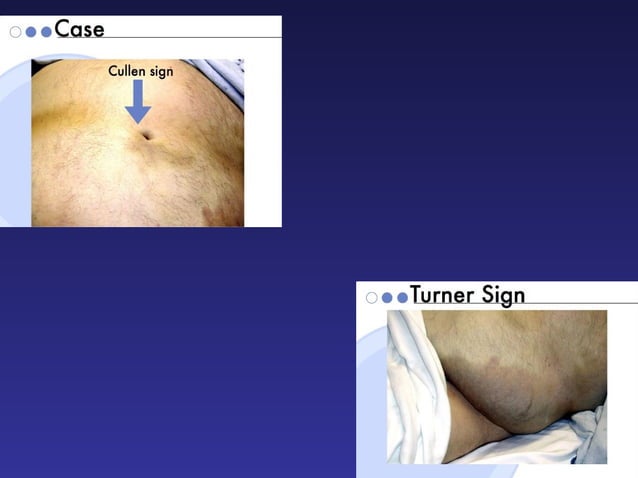Exam Of Abdomen. | PPT | Digestive Disorders | Diseases and Conditions