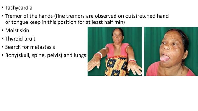 Exam of thyrod gland | PPT