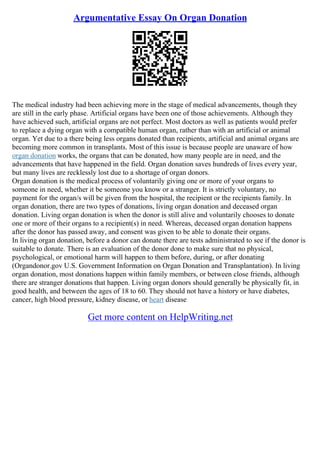 Example Of An Argumentative Essay | PDF