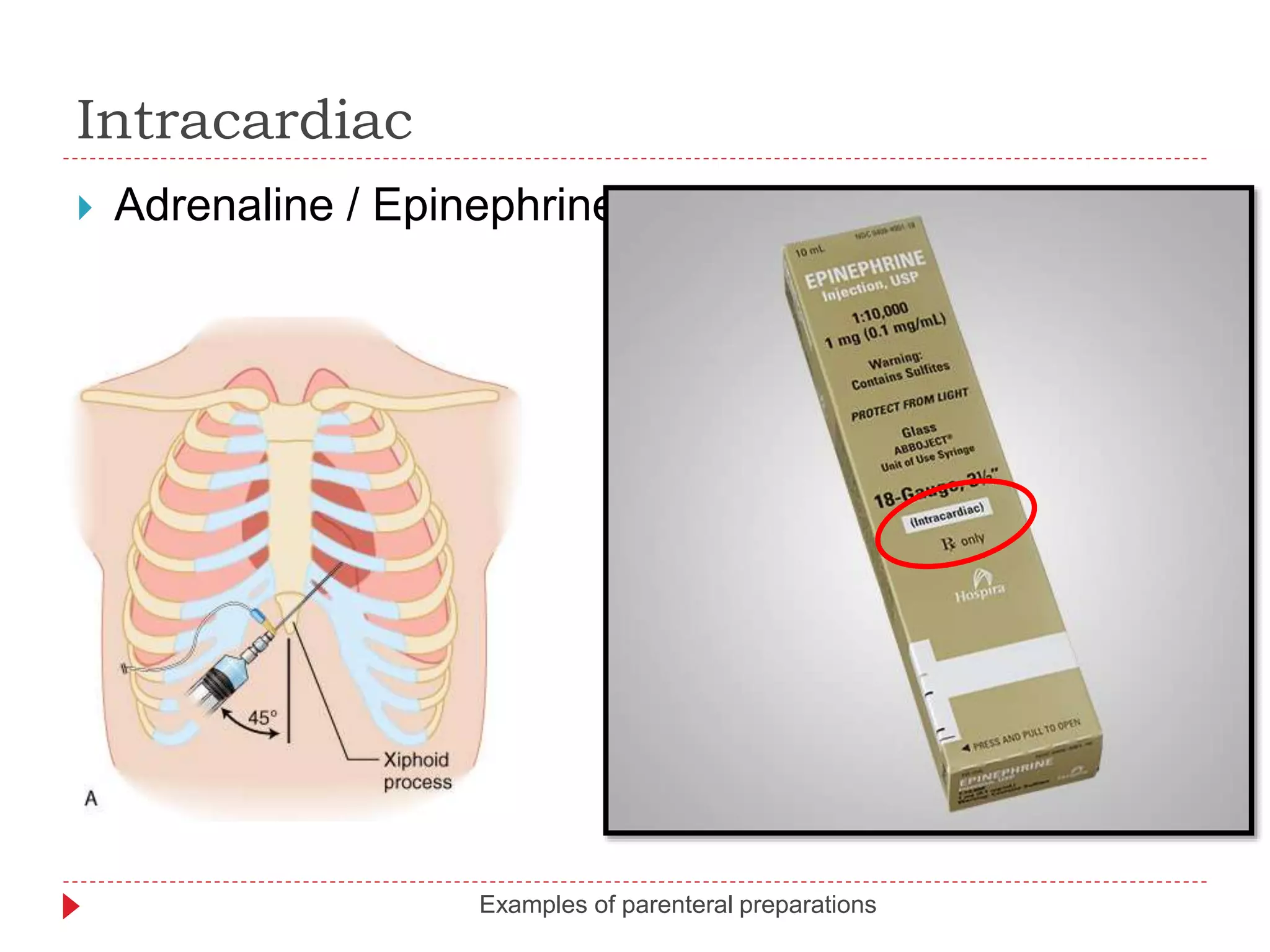 Examples of parenteral preparations | PPTX