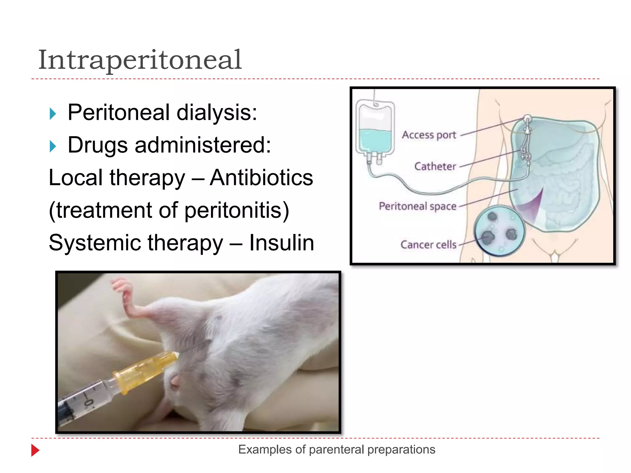 Examples of parenteral preparations | PPTX