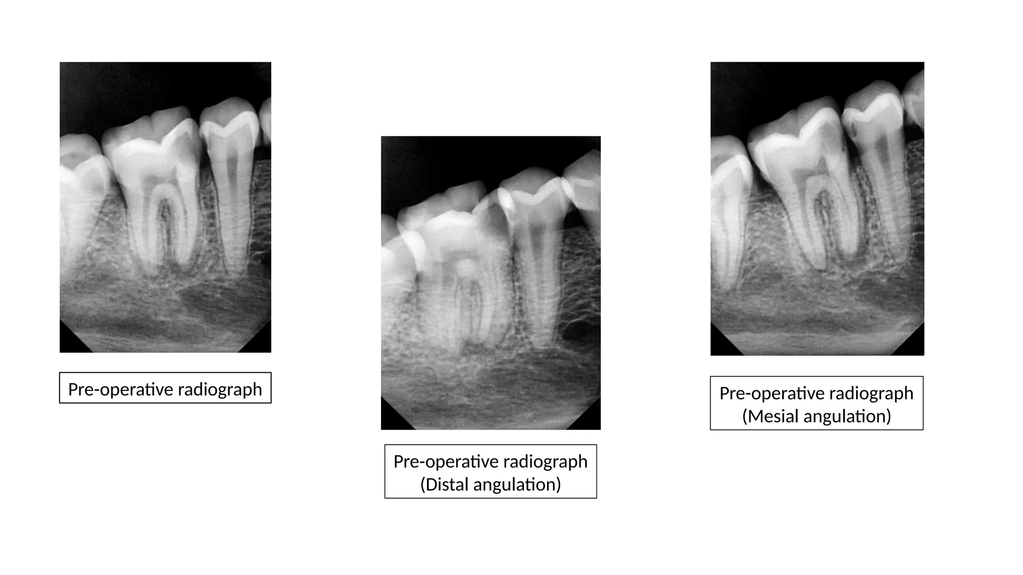 RCT EXAM CASE REPORT NNBHN CVB BBHHNVRERC PT.pptx