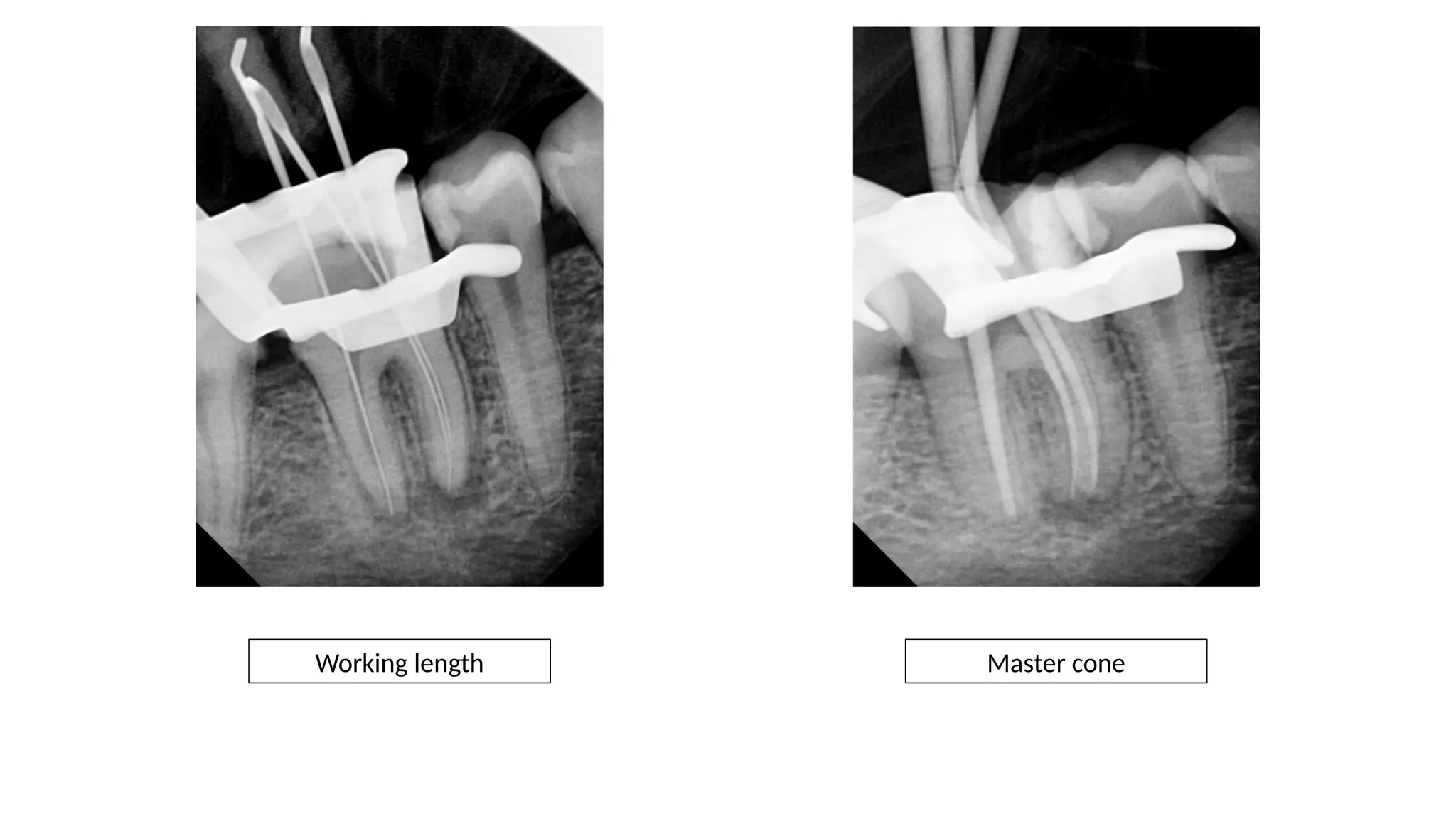 RCT EXAM CASE REPORT NNBHN CVB BBHHNVRERC PT.pptx