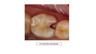 RCT EXAM CASE REPORT NNBHN CVB BBHHNVRERC PT.pptx