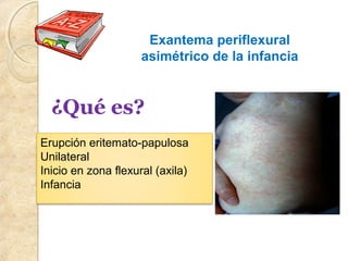 Exantema periflexural asimetrico | PPT