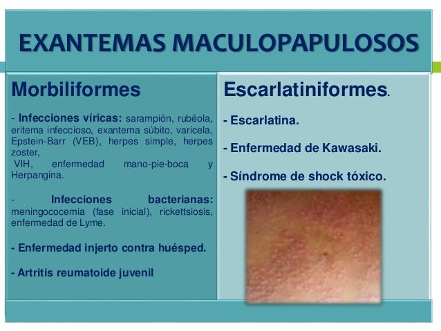 Exantemas de la infancia
