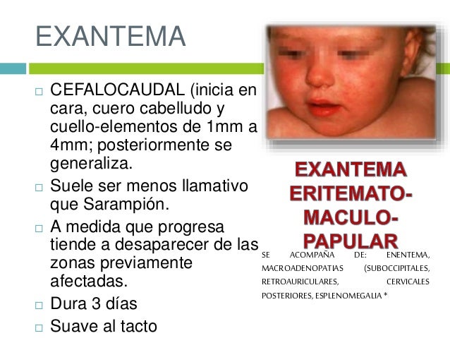 Exantemas de la infancia