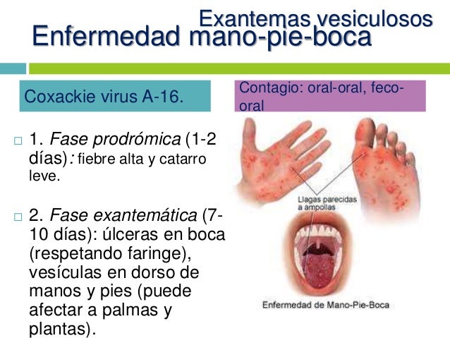 Exantemas de la infancia
