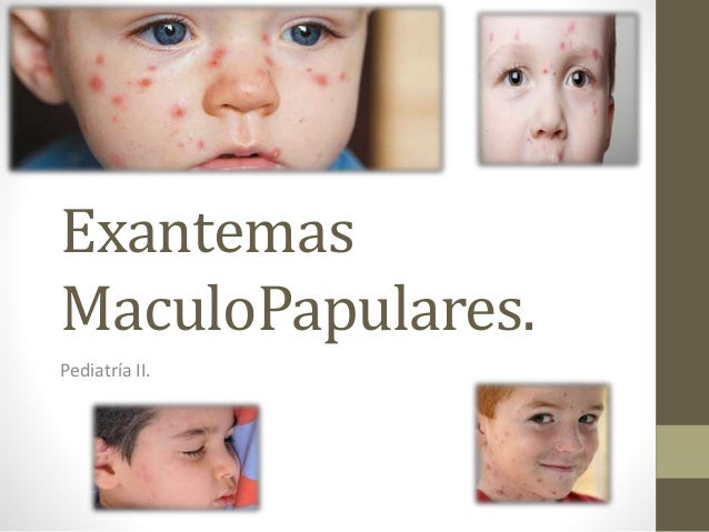 Exantemas maculo papulares
