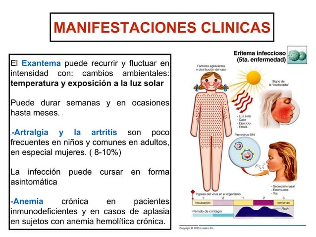 Exantema subito y eritema infeccioso | PPTX