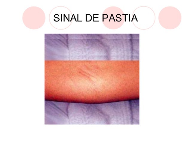 Doenças exantemáticas em pediatria