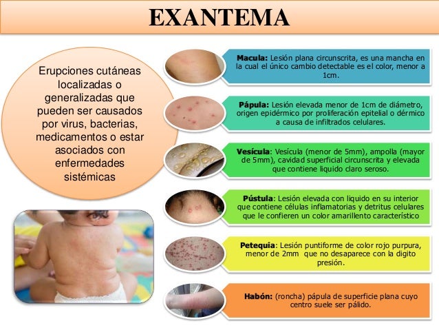 Exantematicas pediatria