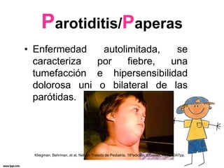 Exantema y parotiditis | PPTX