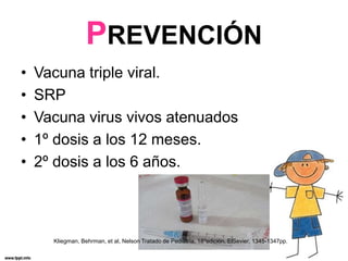 Exantema y parotiditis | PPTX