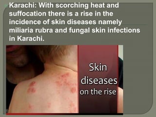 Exanthema (rash) in pakistan | PPT