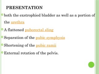 extrophy of bladder .pptx child health nursing | PPT
