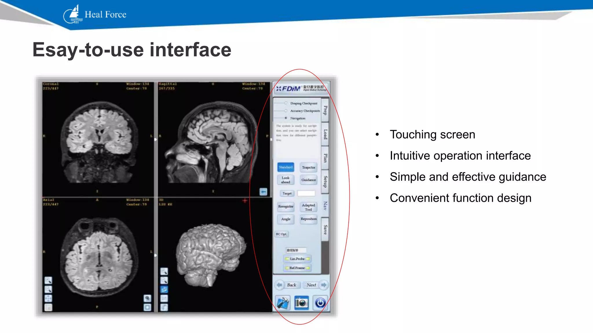 Heal Force: Excelim 04 Image guided Surgery for cranial and ENT ...