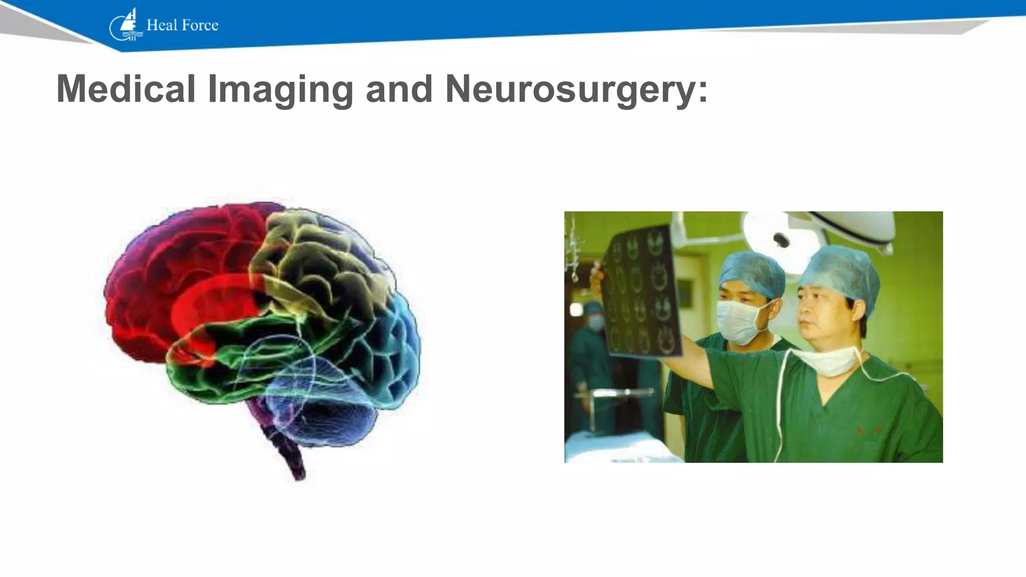 Heal Force: Excelim 04 Image guided Surgery for cranial and ENT ...