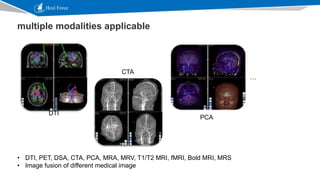 Heal Force: Excelim 04 Image guided Surgery for cranial and ENT ...