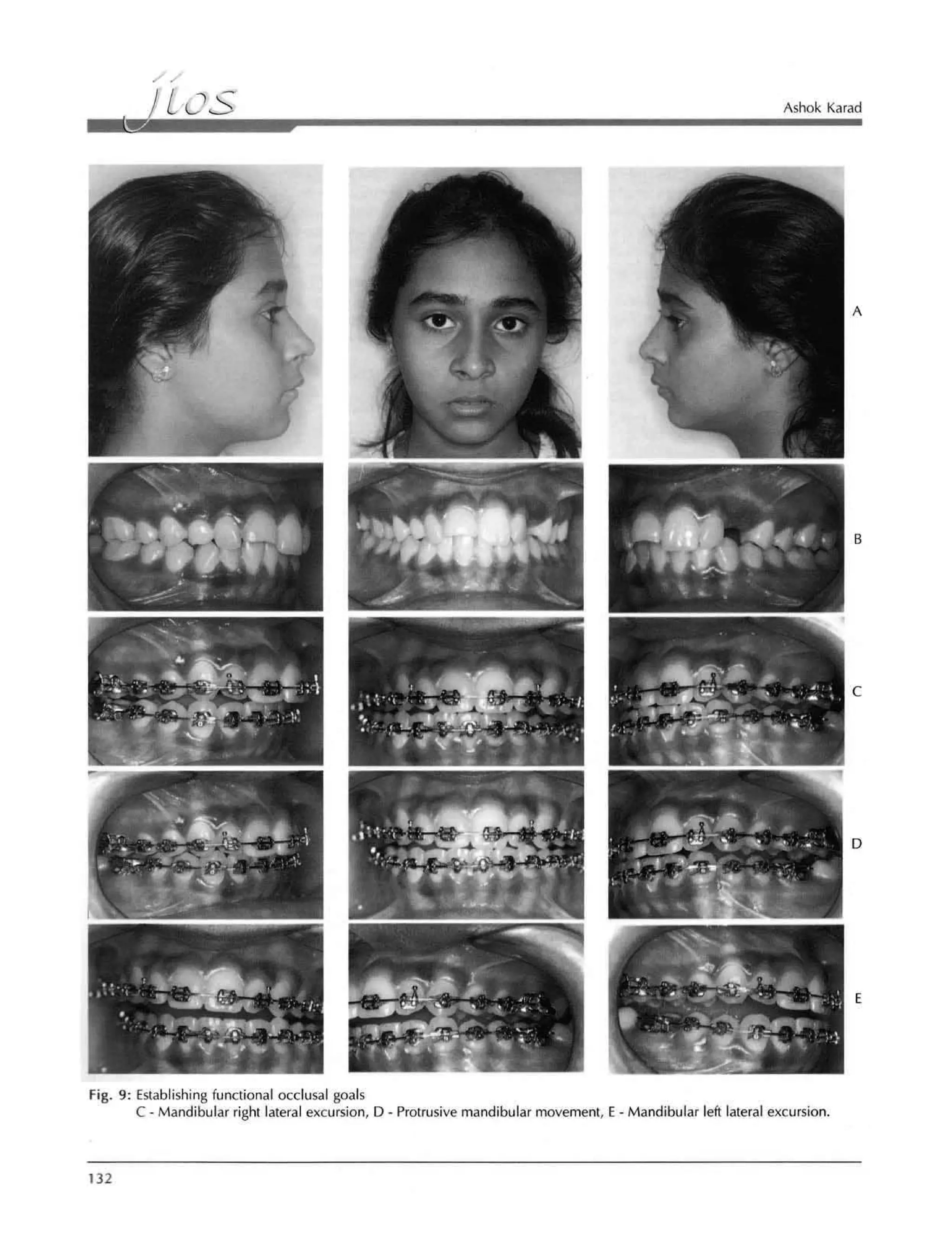 !Excellence in finishing current concepts goals and mechanics (1) | PDF