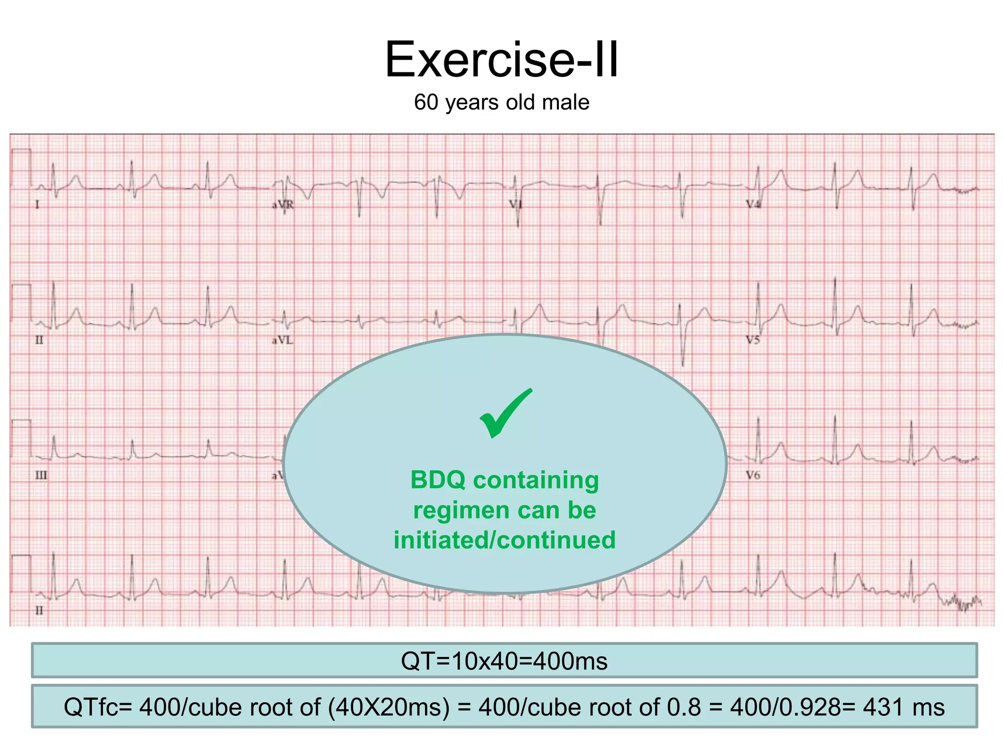 Excercise corrected qt interval (q tc) ecg interpretation | PPTX ...