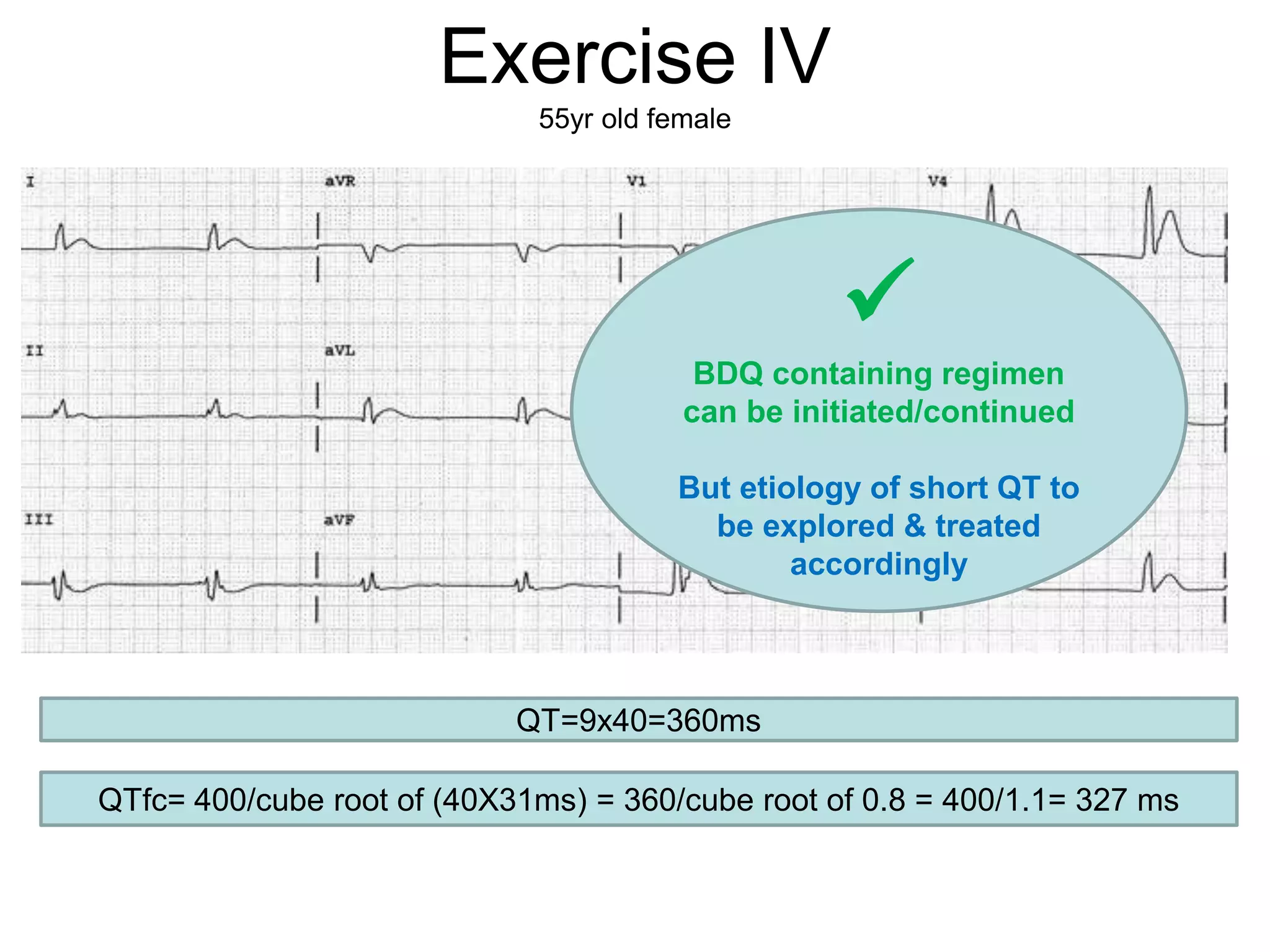 Excercise corrected qt interval (q tc) ecg interpretation | PPTX