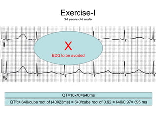 Excercise corrected qt interval (q tc) ecg interpretation | PPTX ...