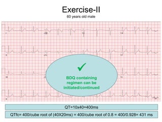 Excercise corrected qt interval (q tc) ecg interpretation | PPTX ...