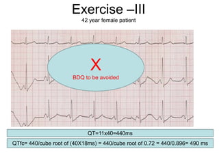 Excercise corrected qt interval (q tc) ecg interpretation | PPTX