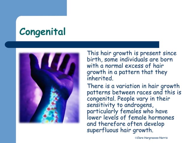 Excess hair growth | PPT