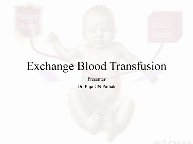 Exchange blood transfusion | PPTX | Blood Disorders | Diseases and Conditions
